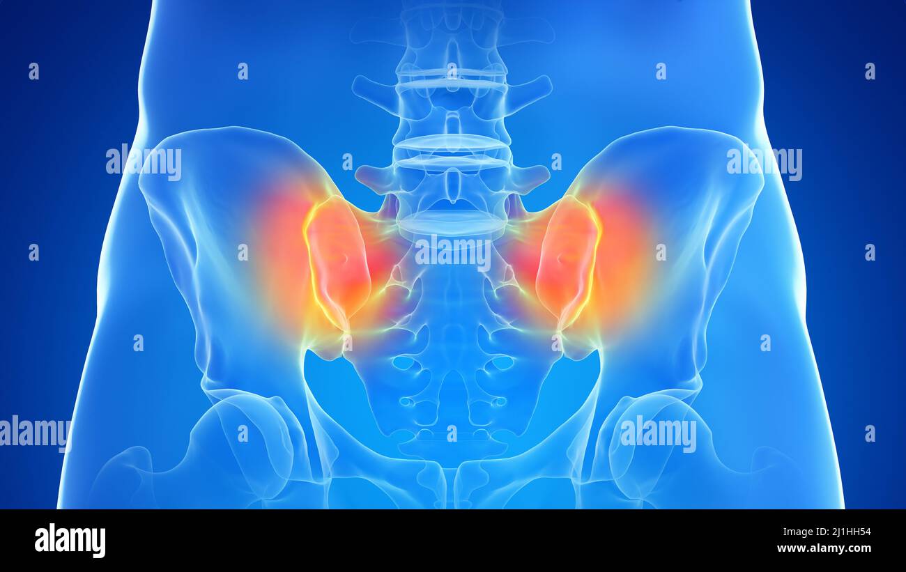 Painful sacroiliac joint, illustration Stock Photo - Alamy