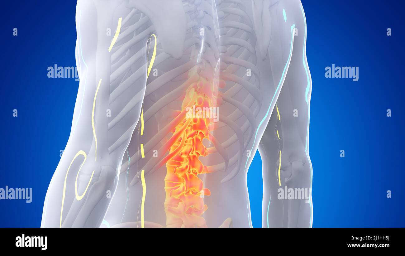 Painful spine, illustration Stock Photo - Alamy