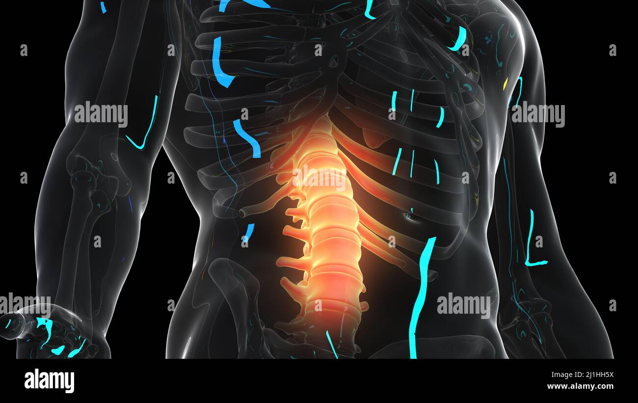 Painful spine, illustration Stock Photo - Alamy