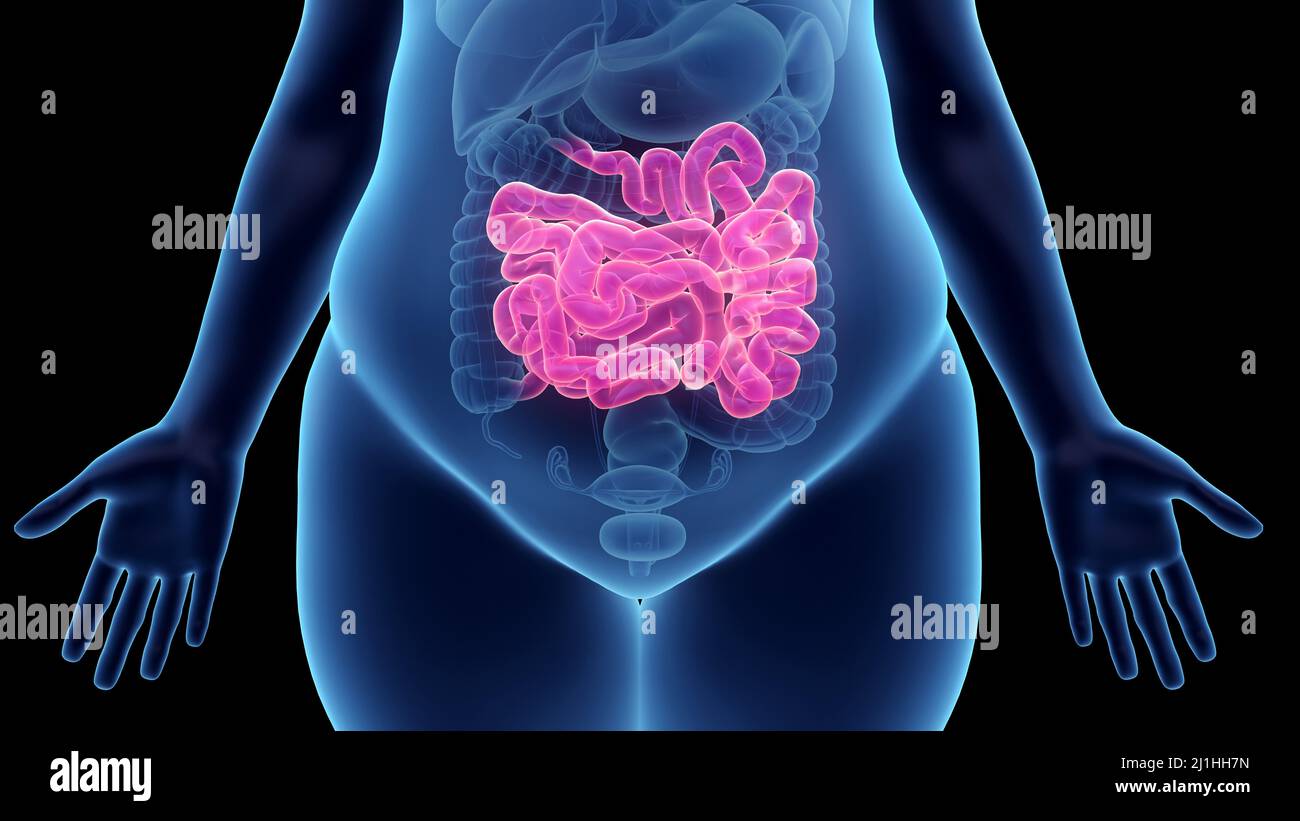 Obese woman's small intestine, illustration Stock Photo - Alamy