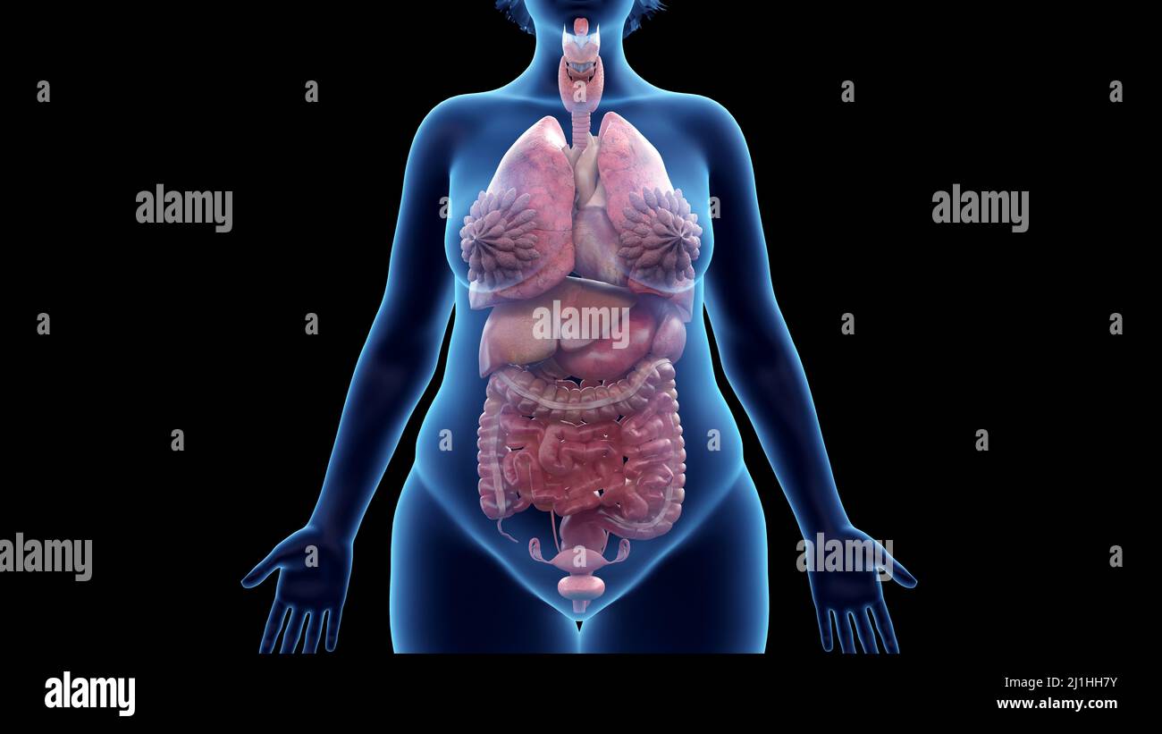 Obese woman's organs, illustration Stock Photo - Alamy