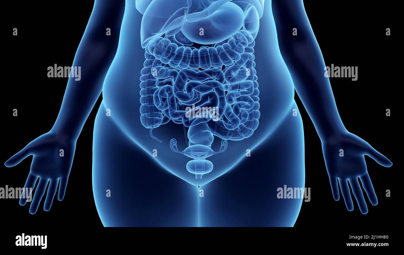 Obese woman's abdominal organs, illustration Stock Photo - Alamy