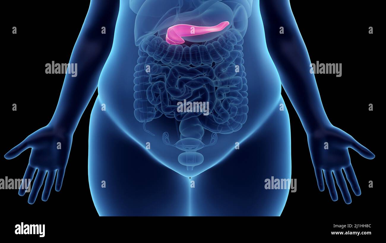 Obese woman's pancreas, illustration Stock Photo - Alamy