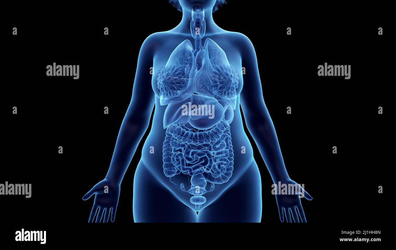 Obese woman's organs, illustration Stock Photo - Alamy
