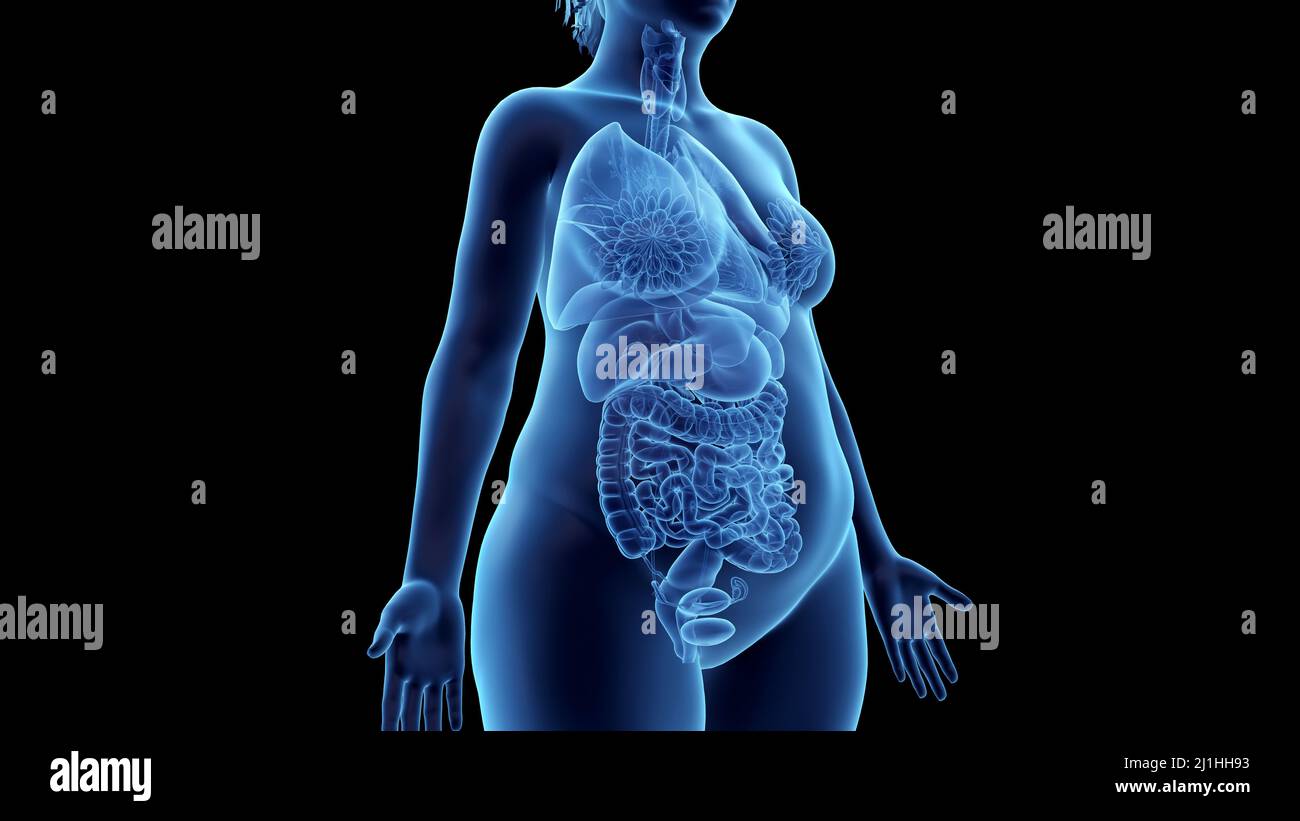 Obese woman's organs, illustration Stock Photo - Alamy