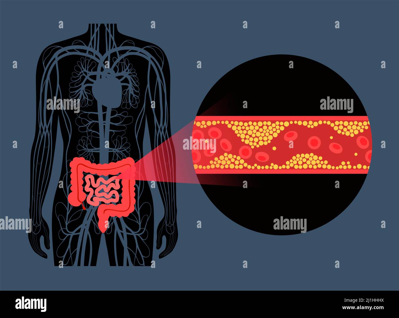 Mesenteric artery hi-res stock photography and images - Alamy