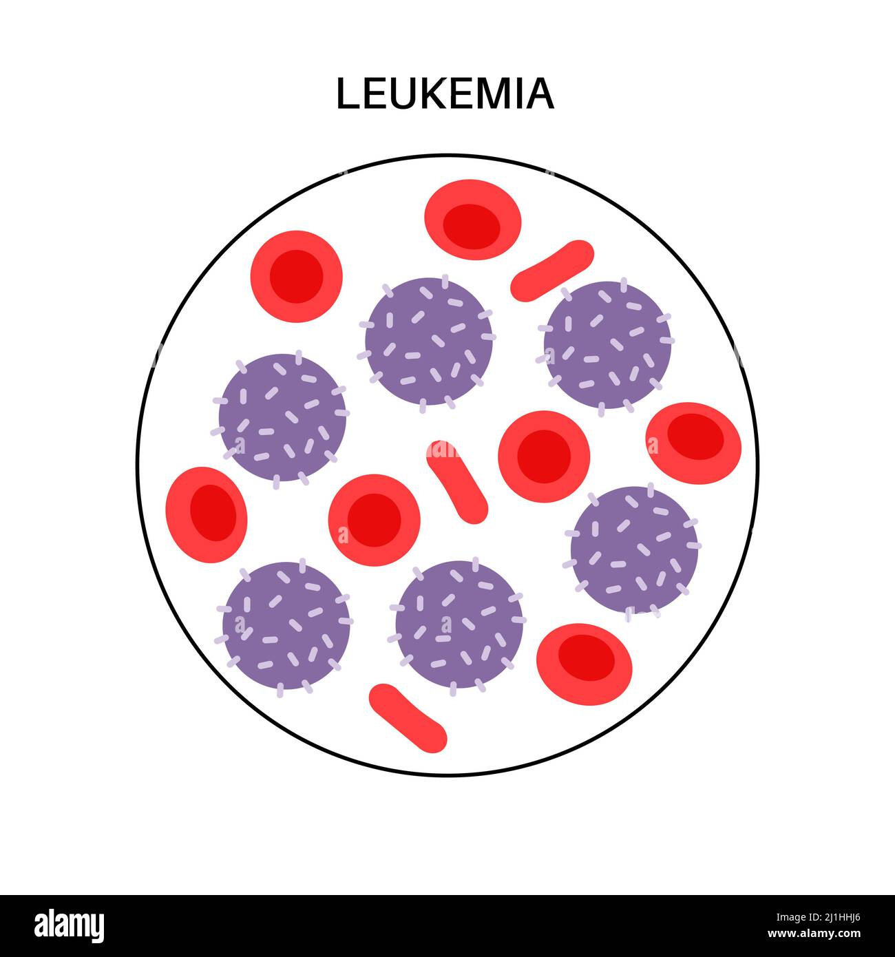 Myeloid leukaemia cells hi-res stock photography and images - Alamy