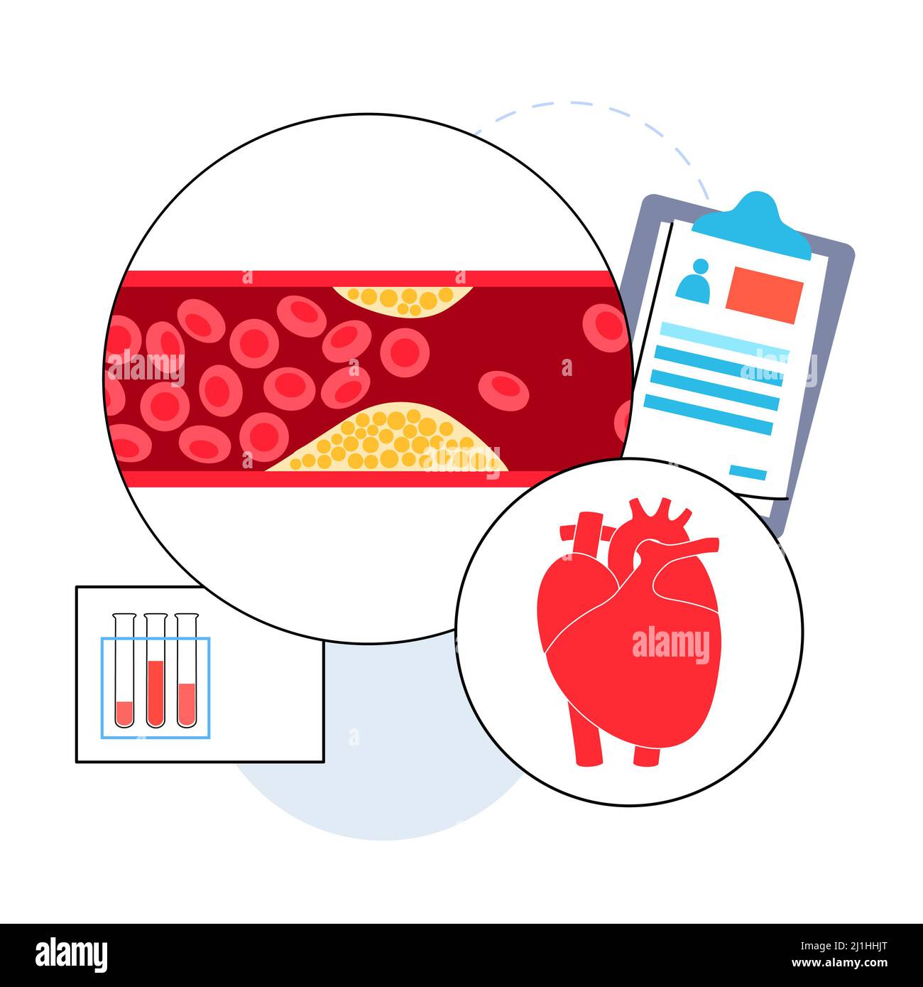 Ischemic heart disease Cut Out Stock Images & Pictures - Alamy