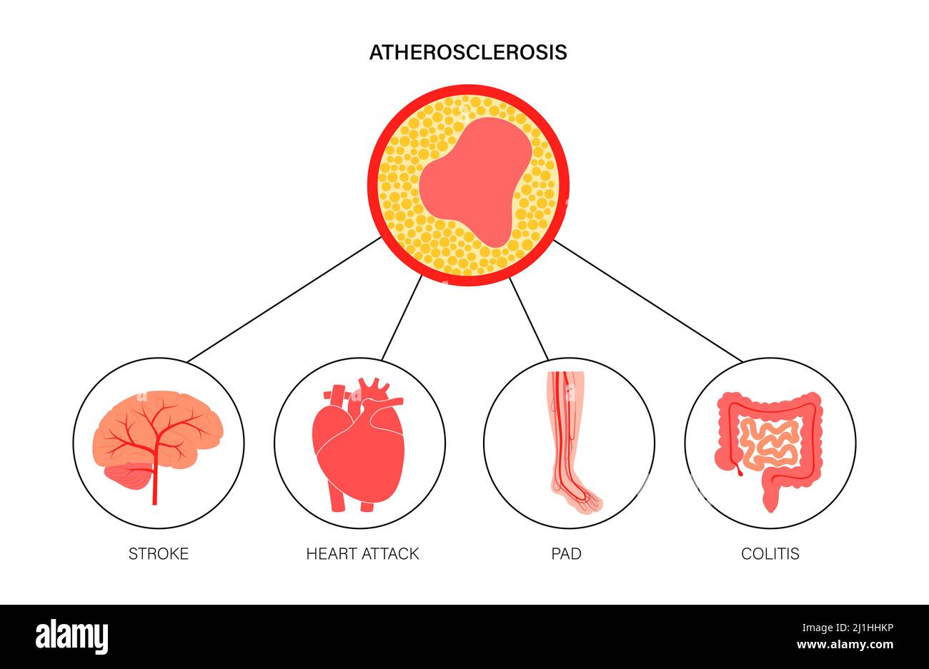 Leg types Cut Out Stock Images & Pictures - Alamy