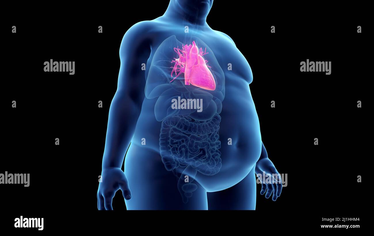 Obese man's heart, illustration Stock Photo - Alamy