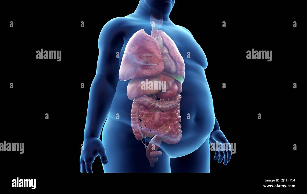 Obese man's organs, illustration Stock Photo - Alamy