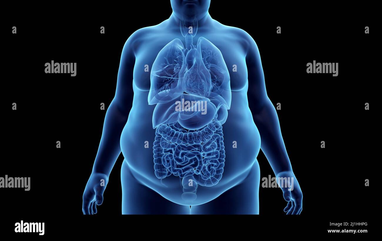 Obese man's organs, illustration Stock Photo - Alamy