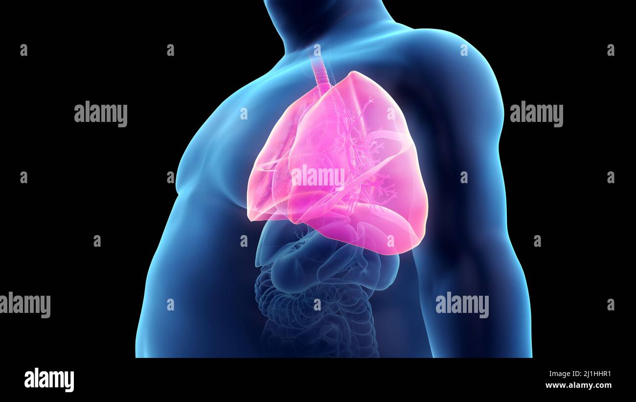 Obese man's lung, illustration Stock Photo - Alamy