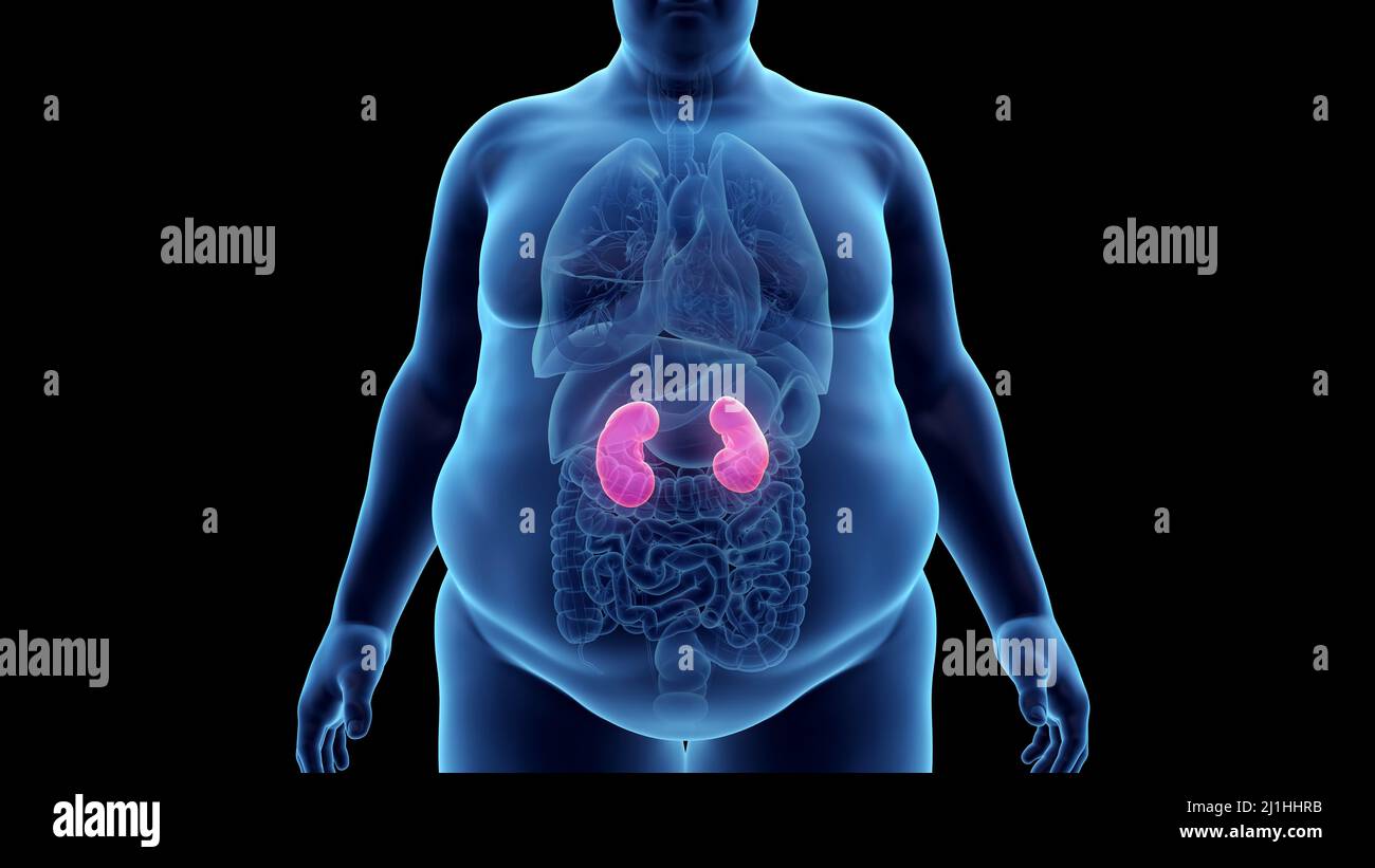 Obese man's kidneys, illustration Stock Photo - Alamy