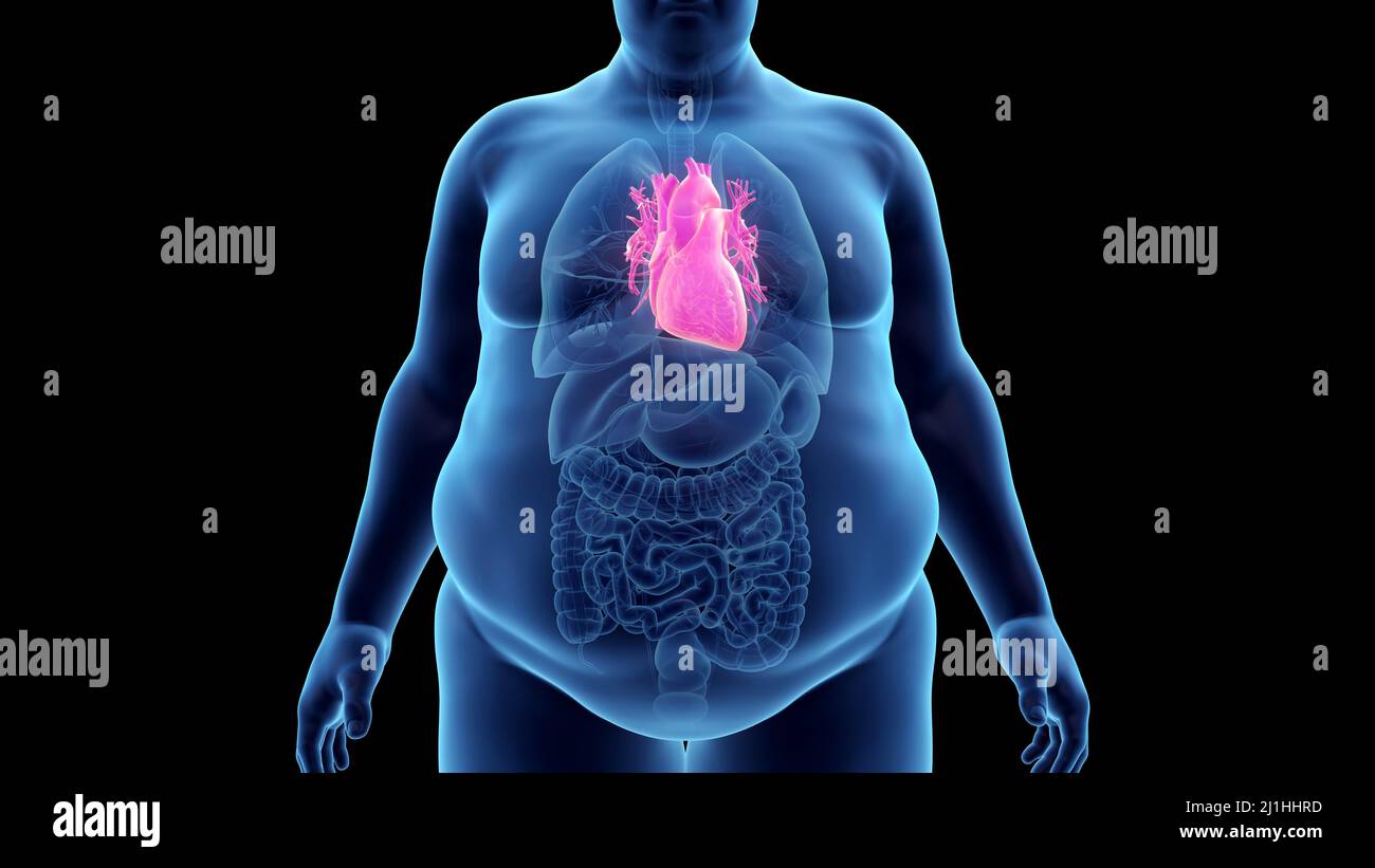 Obese man's heart, illustration Stock Photo - Alamy