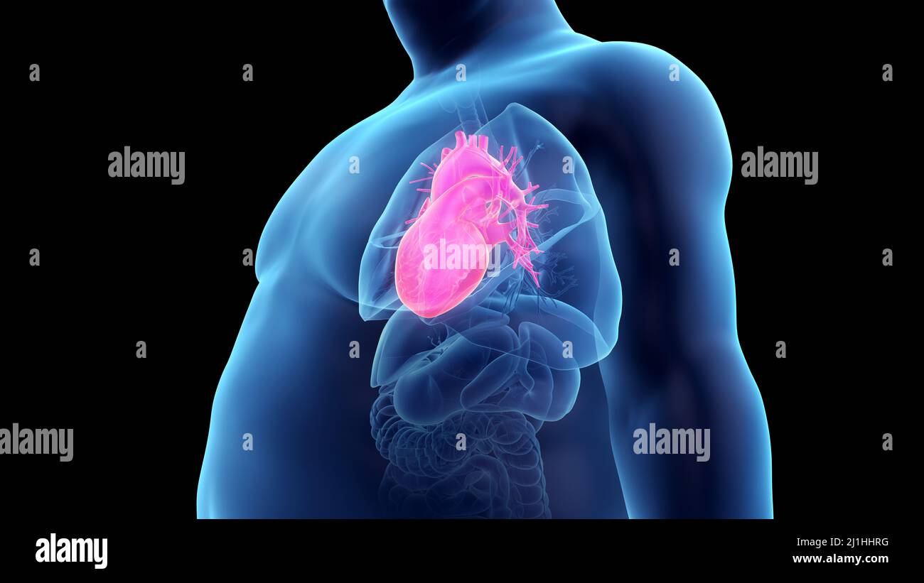 Obese man's heart, illustration Stock Photo - Alamy
