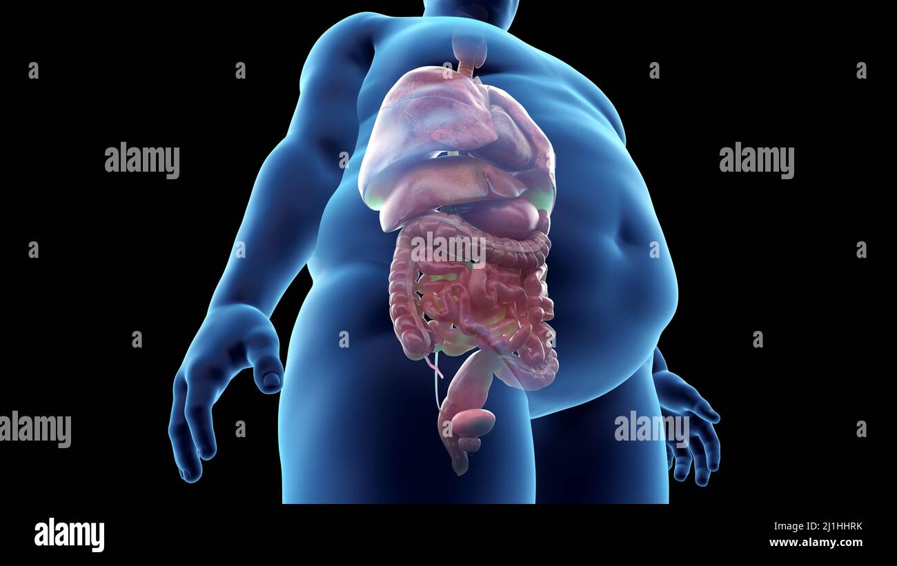 Obese man's organs, illustration Stock Photo - Alamy