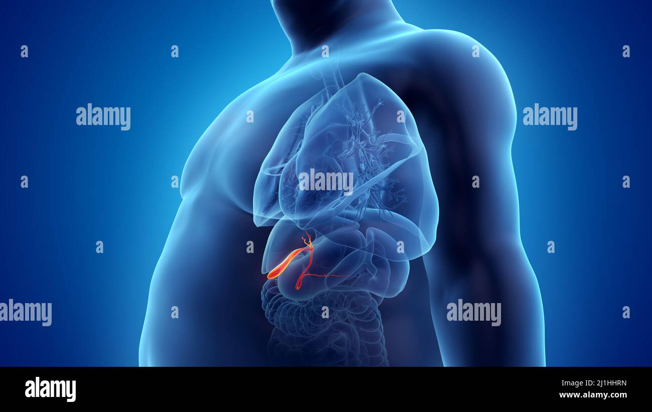 Obese man's gallbladder, illustration Stock Photo - Alamy
