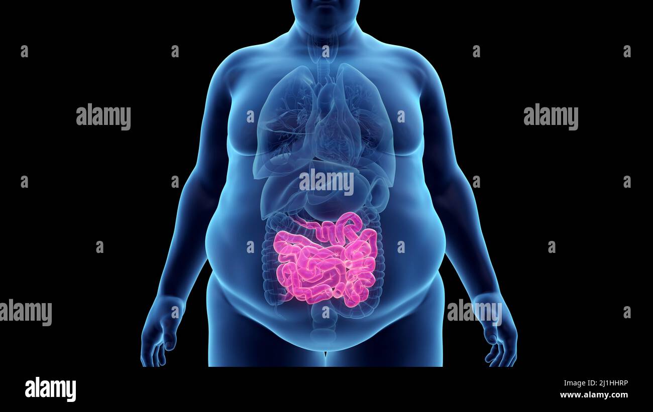 Obese man's small intestine, illustration Stock Photo - Alamy