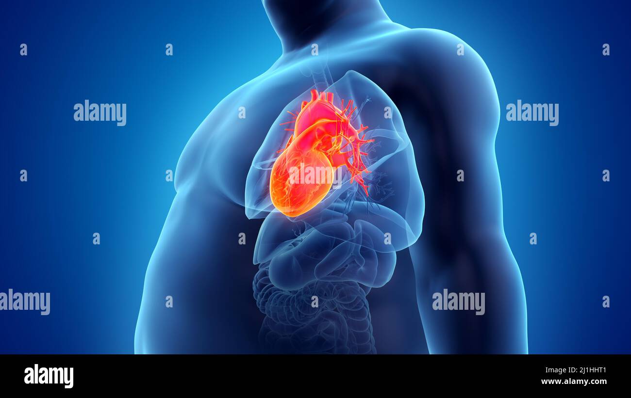 Obese man's heart, illustration Stock Photo - Alamy