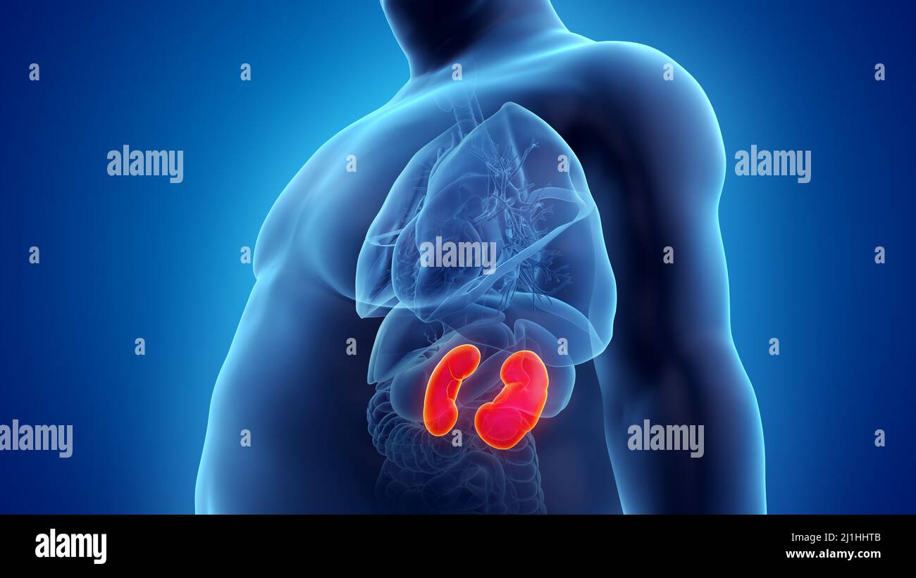 Obese man's kidneys, illustration Stock Photo - Alamy