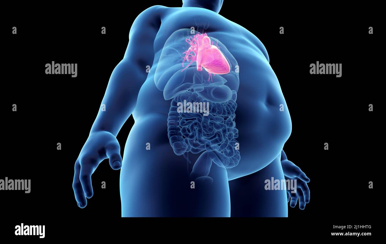 Obese man's heart, illustration Stock Photo - Alamy