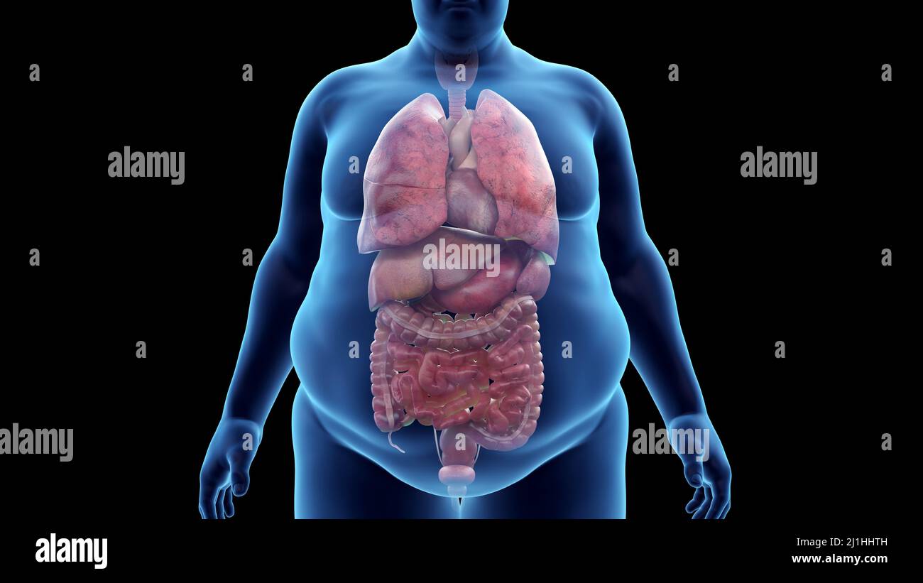 Obese man's organs, illustration Stock Photo - Alamy