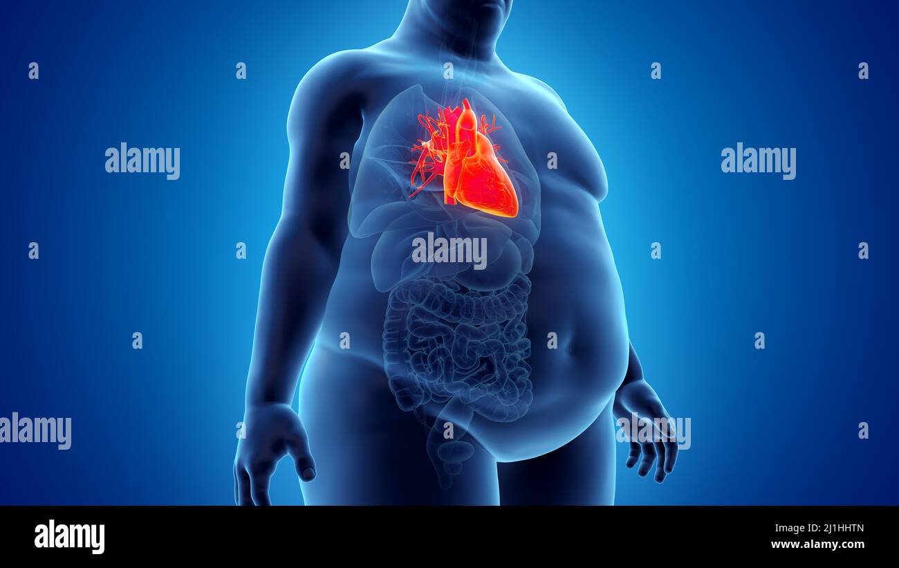Obese man's heart, illustration Stock Photo - Alamy