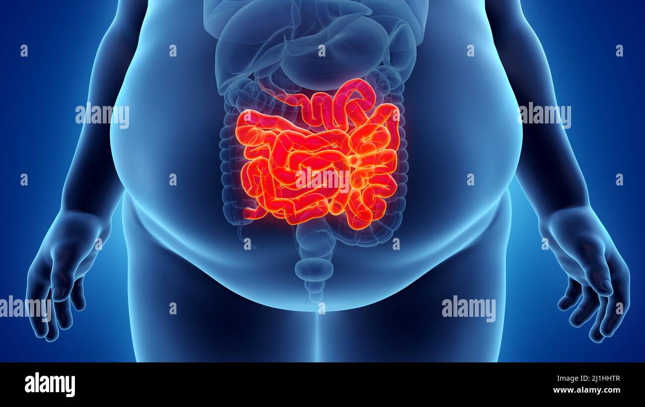 Obese man's small intestine, illustration Stock Photo - Alamy