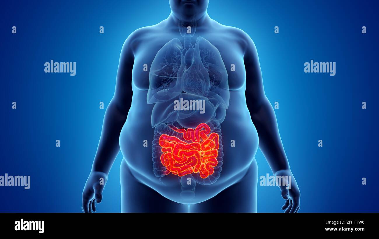 Obese man's small intestine, illustration Stock Photo - Alamy