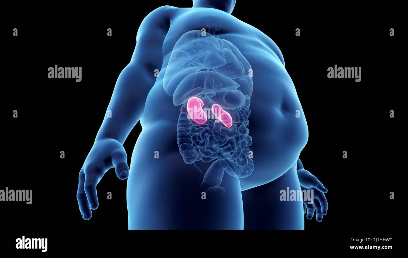 Obese man's kidneys, illustration Stock Photo - Alamy