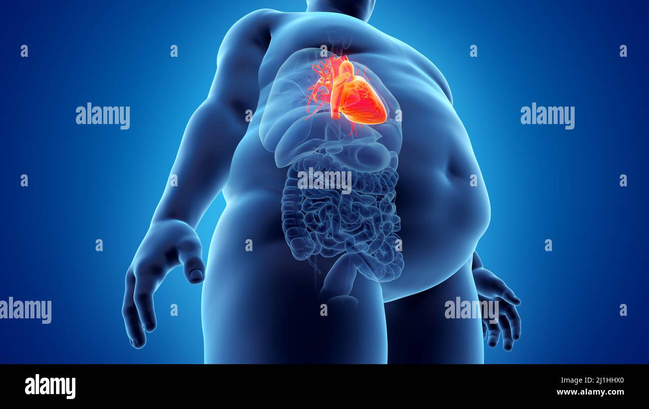 Obese man's heart, illustration Stock Photo - Alamy