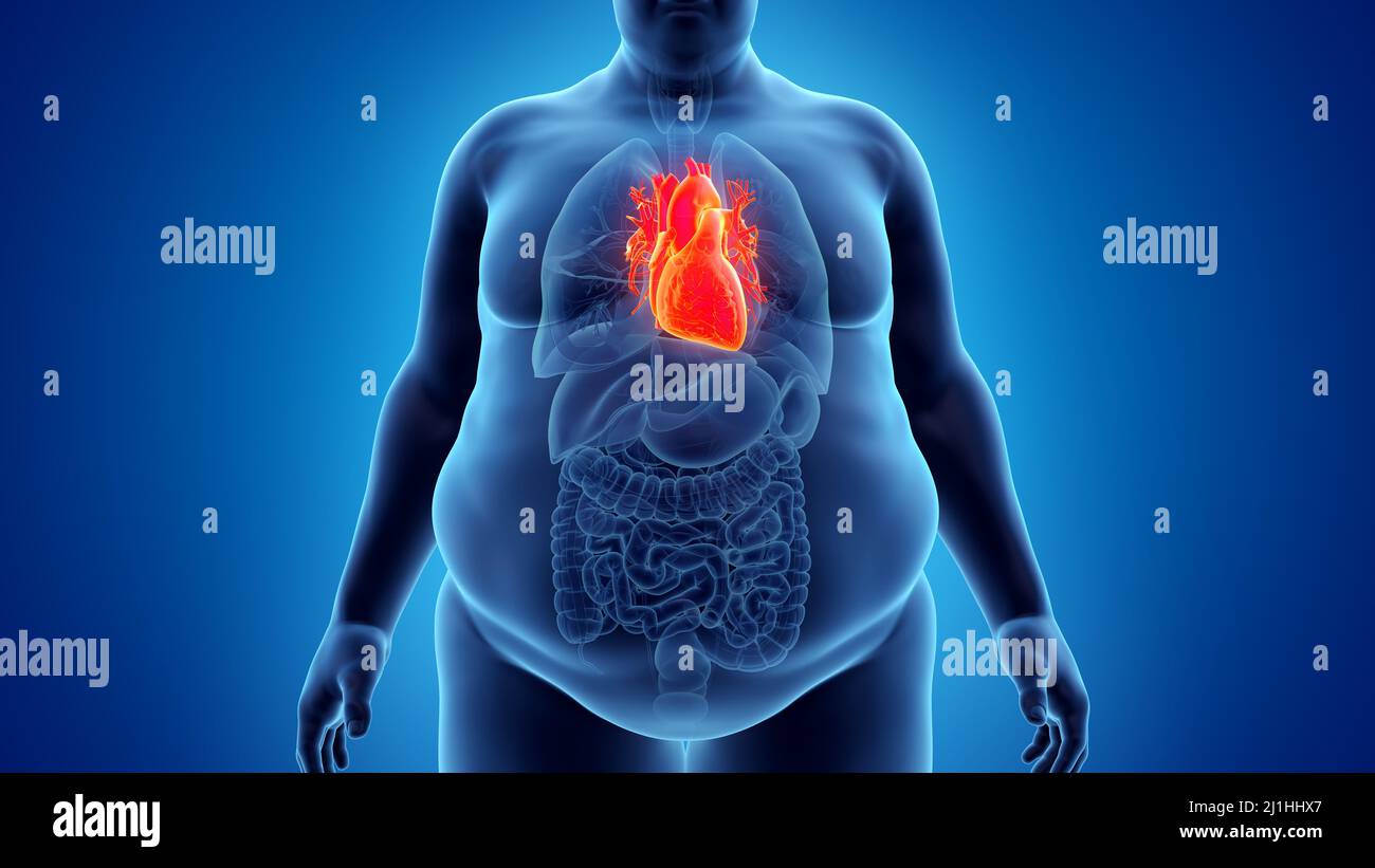 Obese man's heart, illustration Stock Photo - Alamy