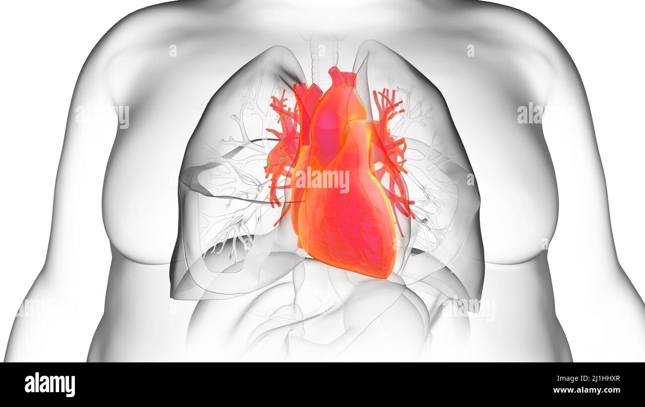 Obese man's heart, illustration Stock Photo - Alamy