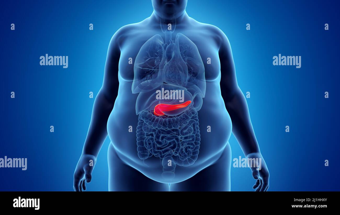 Obese man's pancreas, illustration Stock Photo - Alamy