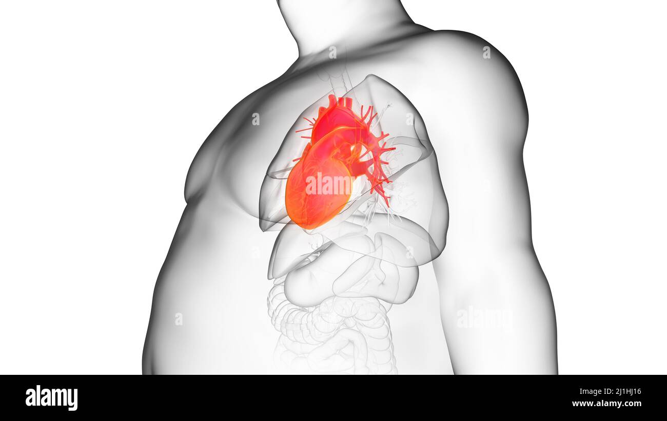 Obese man's heart, illustration Stock Photo - Alamy