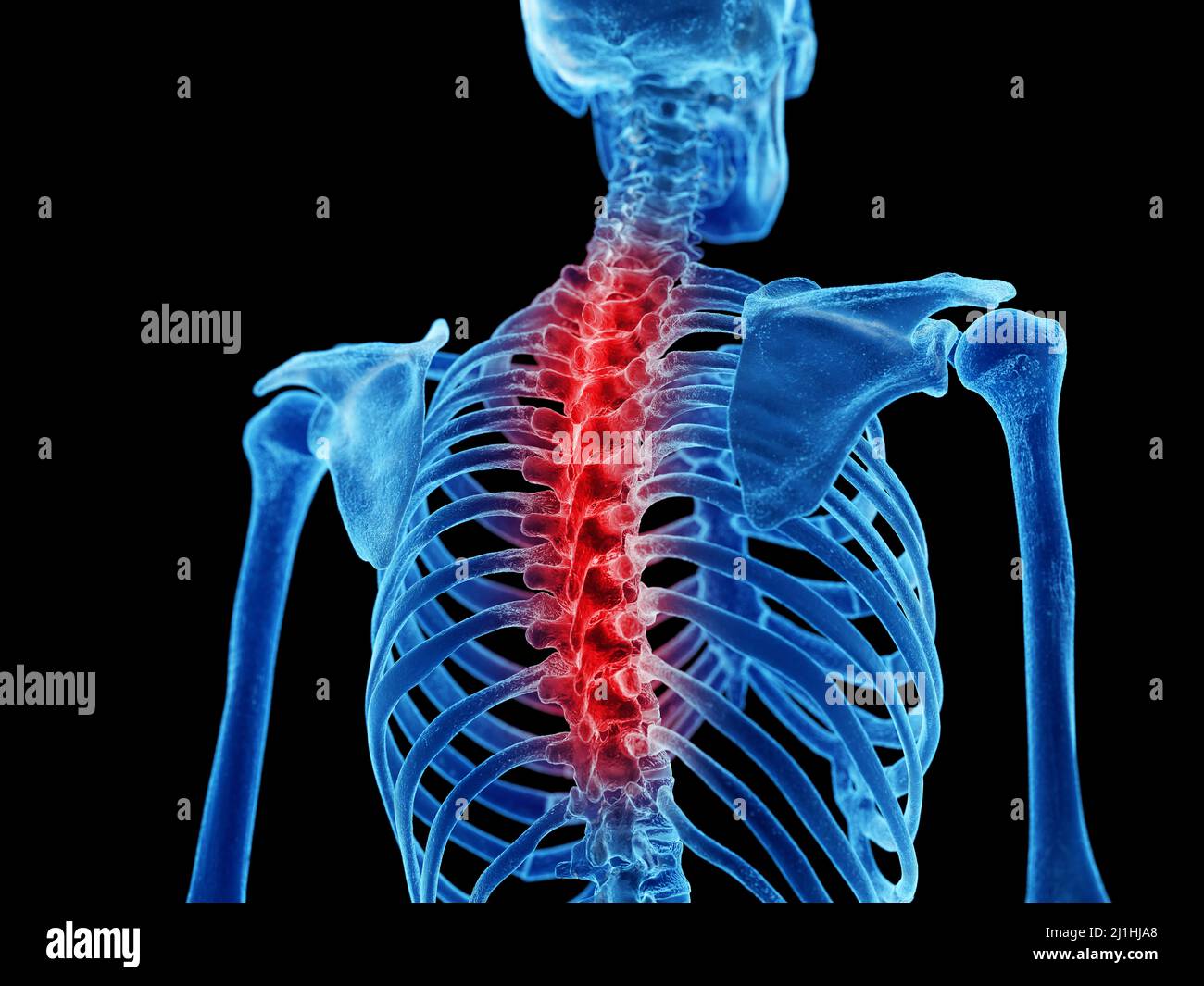 Painful back, illustration Stock Photo - Alamy
