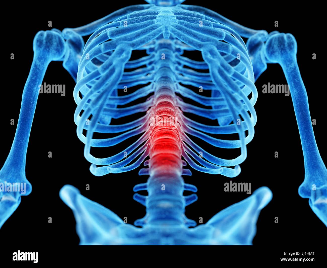 Painful spine, illustration Stock Photo - Alamy