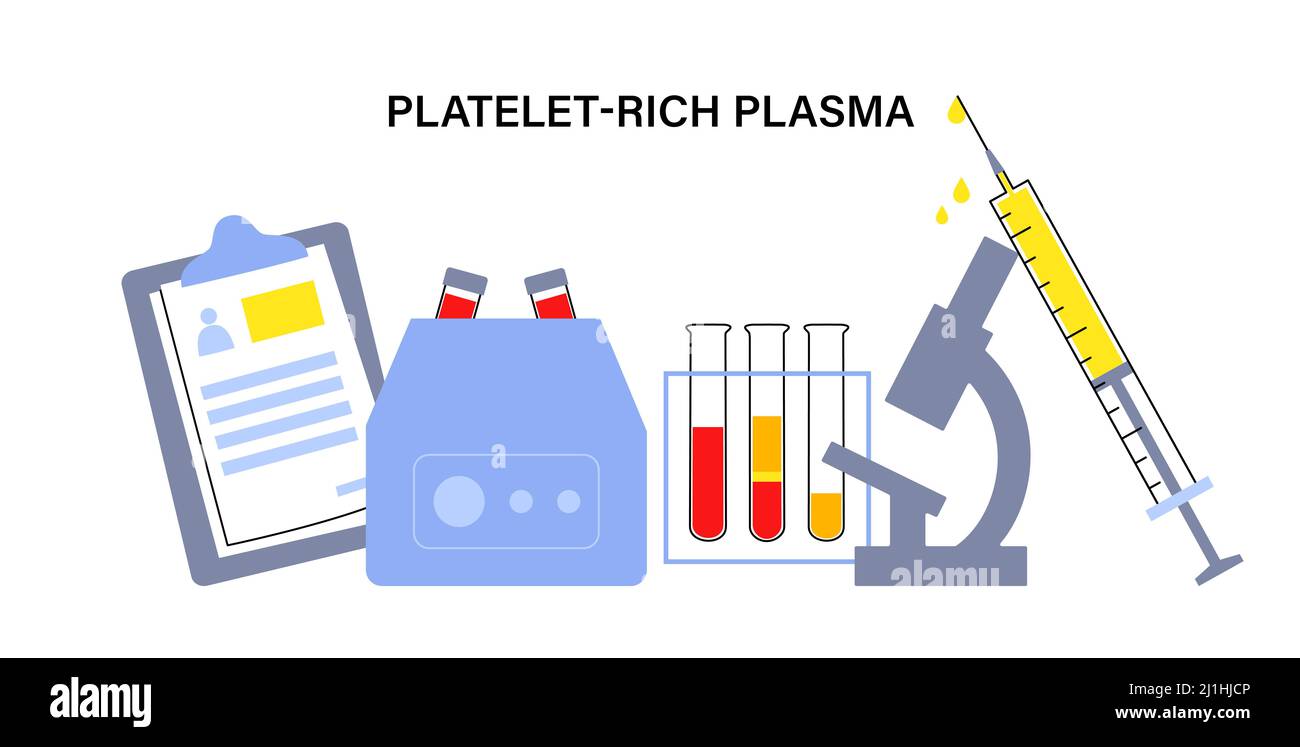 Platelet rich plasma arthritis hi-res stock photography and images - Alamy