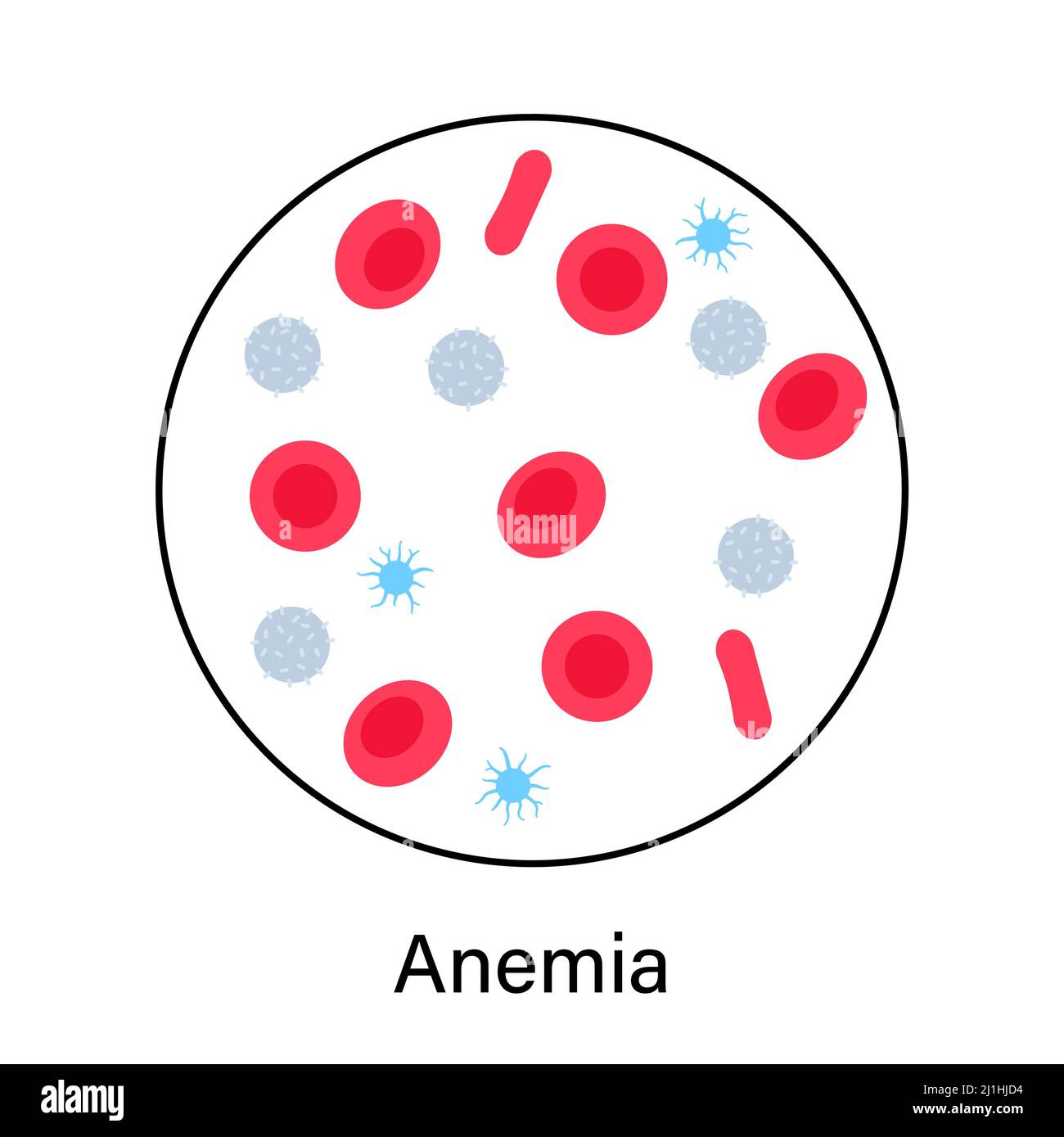 Anaemia blood cells Cut Out Stock Images & Pictures - Alamy