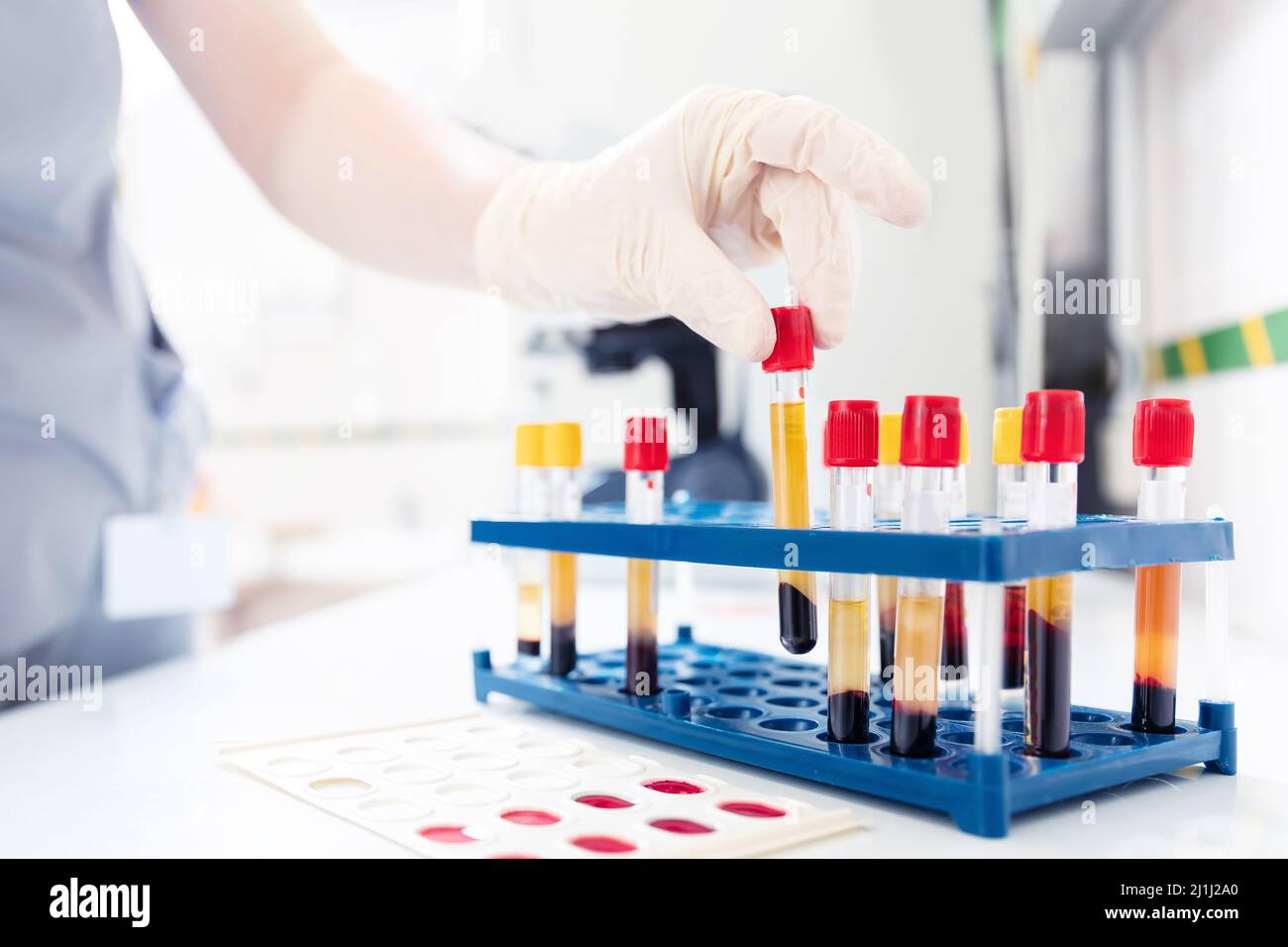 Lab worker preparing test blood for detection of antibodies and ...