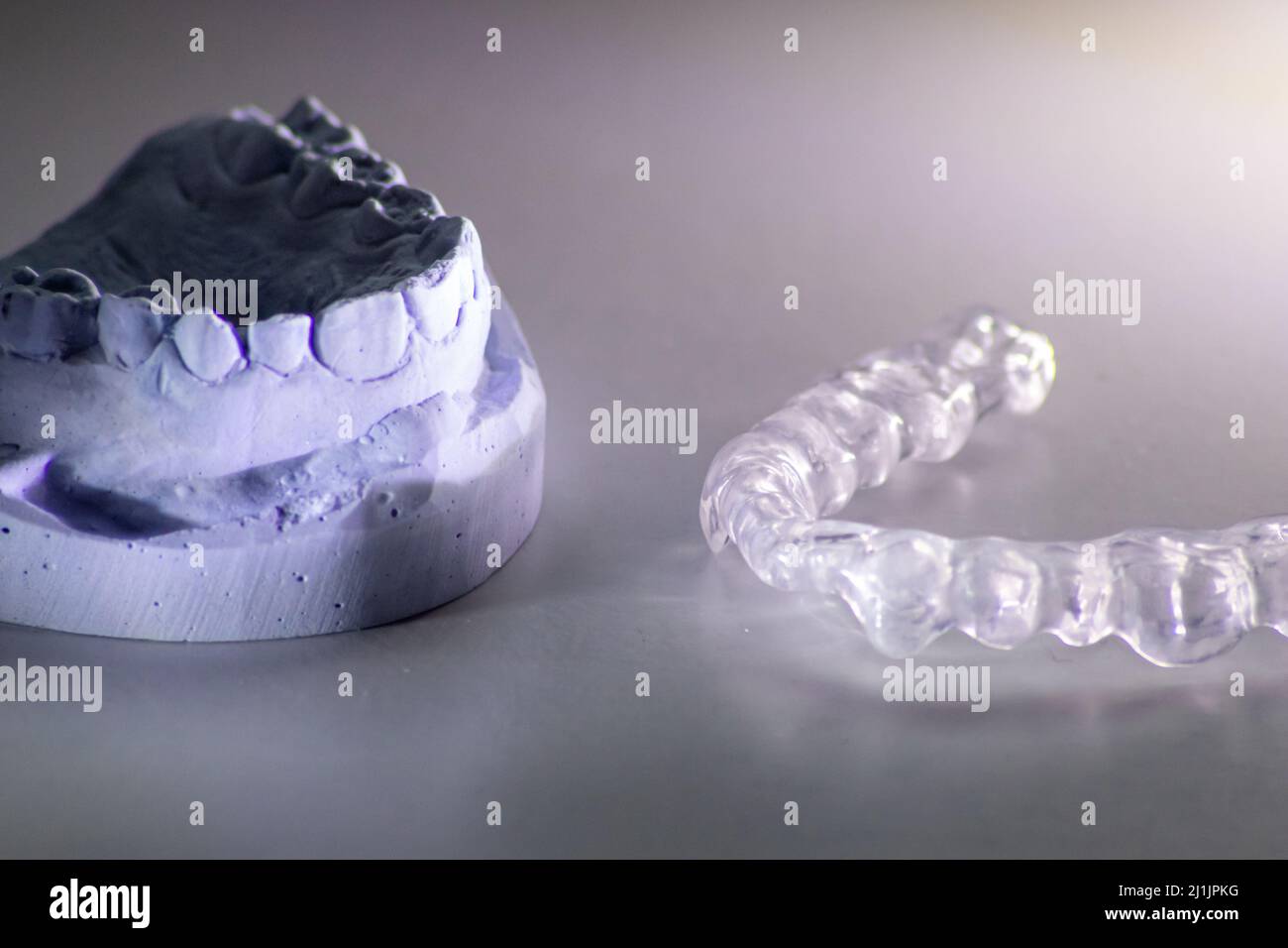 Dental splint against bruxism and grinding teeth with teeth imprint and ...