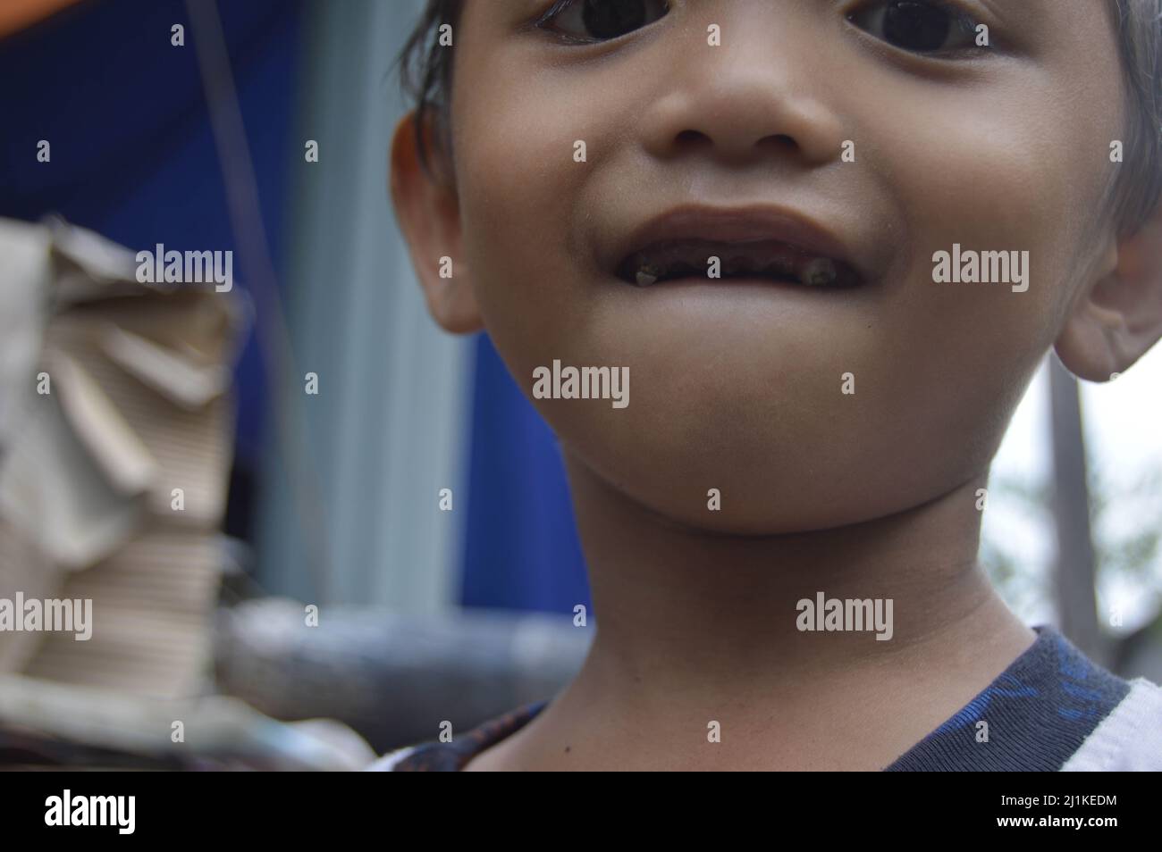 a small child showing his missing teeth Stock Photo - Alamy
