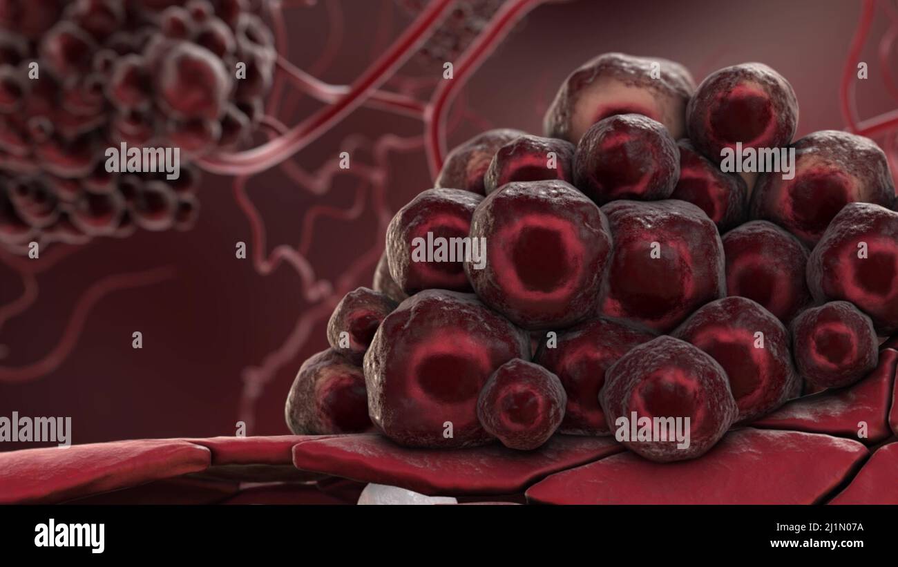 Growing Lump High Resolution Stock Photography and Images - Alamy