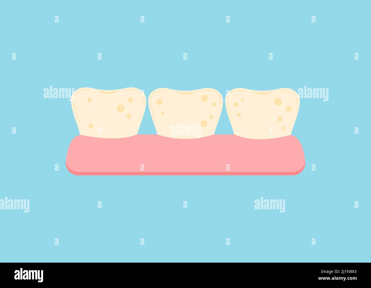 Cute tooth with yellow plaque before whitening icon Stock Vector Image ...