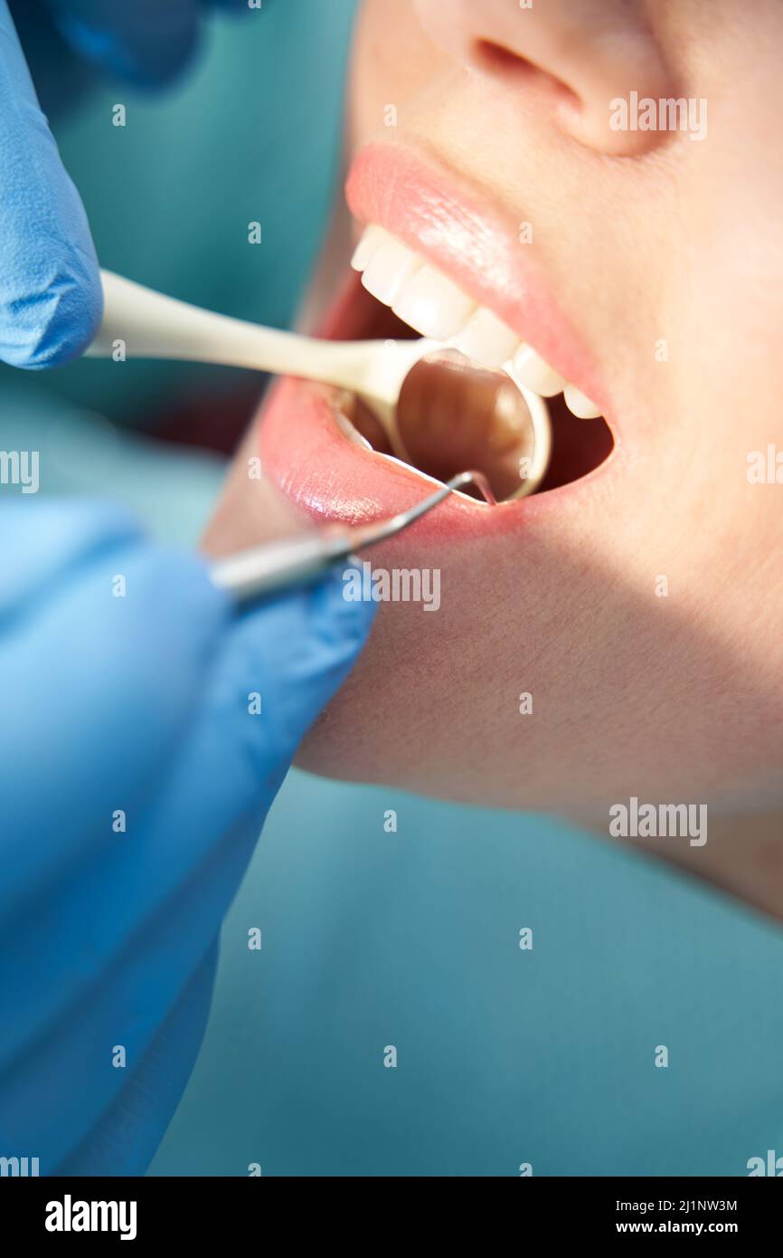 Dentist examining woman teeth in dental clinic Stock Photo - Alamy