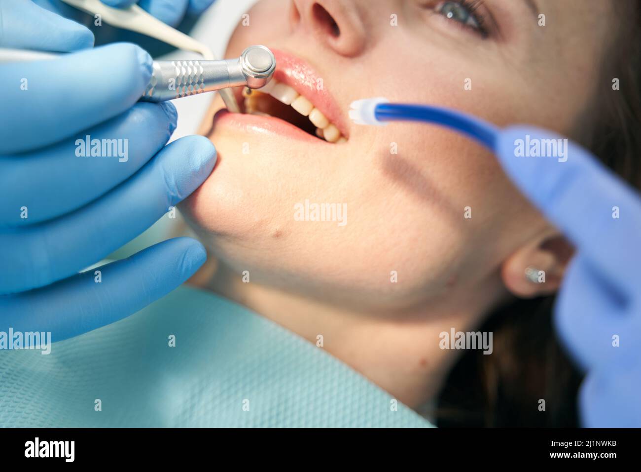 Dentist performing oral hygiene procedure hi-res stock photography and ...