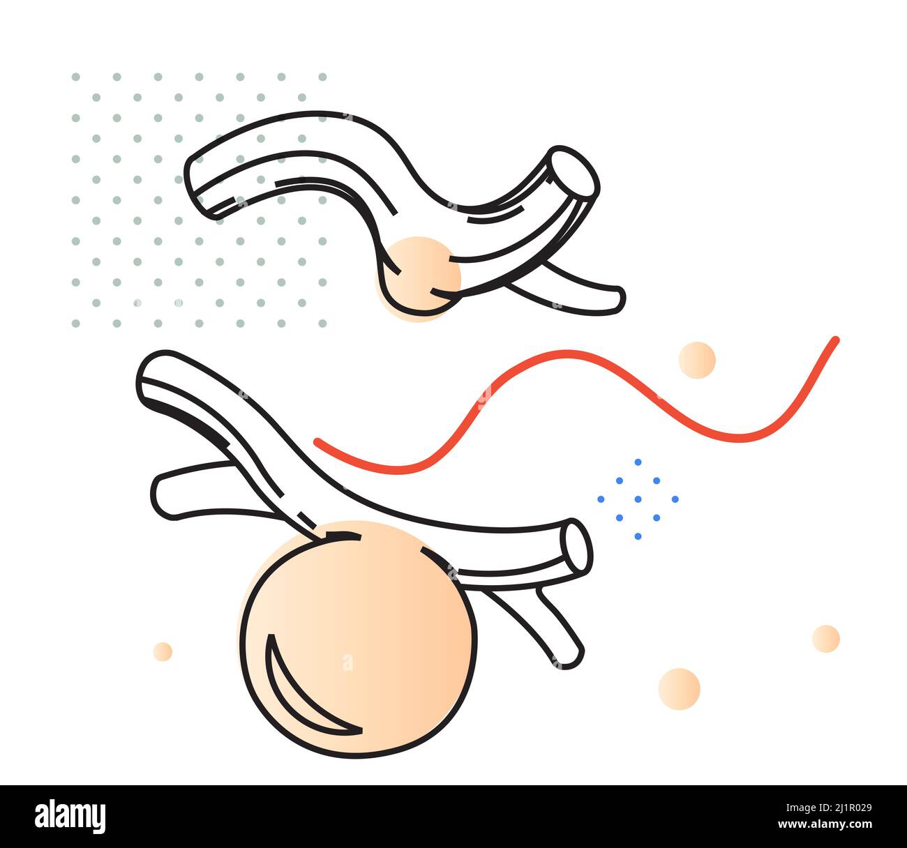Aneurysm buildup over a period of time - Stock Icon as EPS 10 File ...