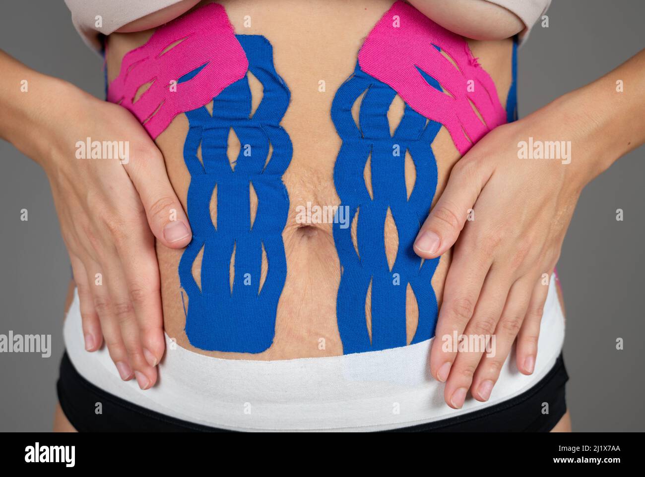 Female belly with physio tape. The theme kinesiology taping, stretching ...