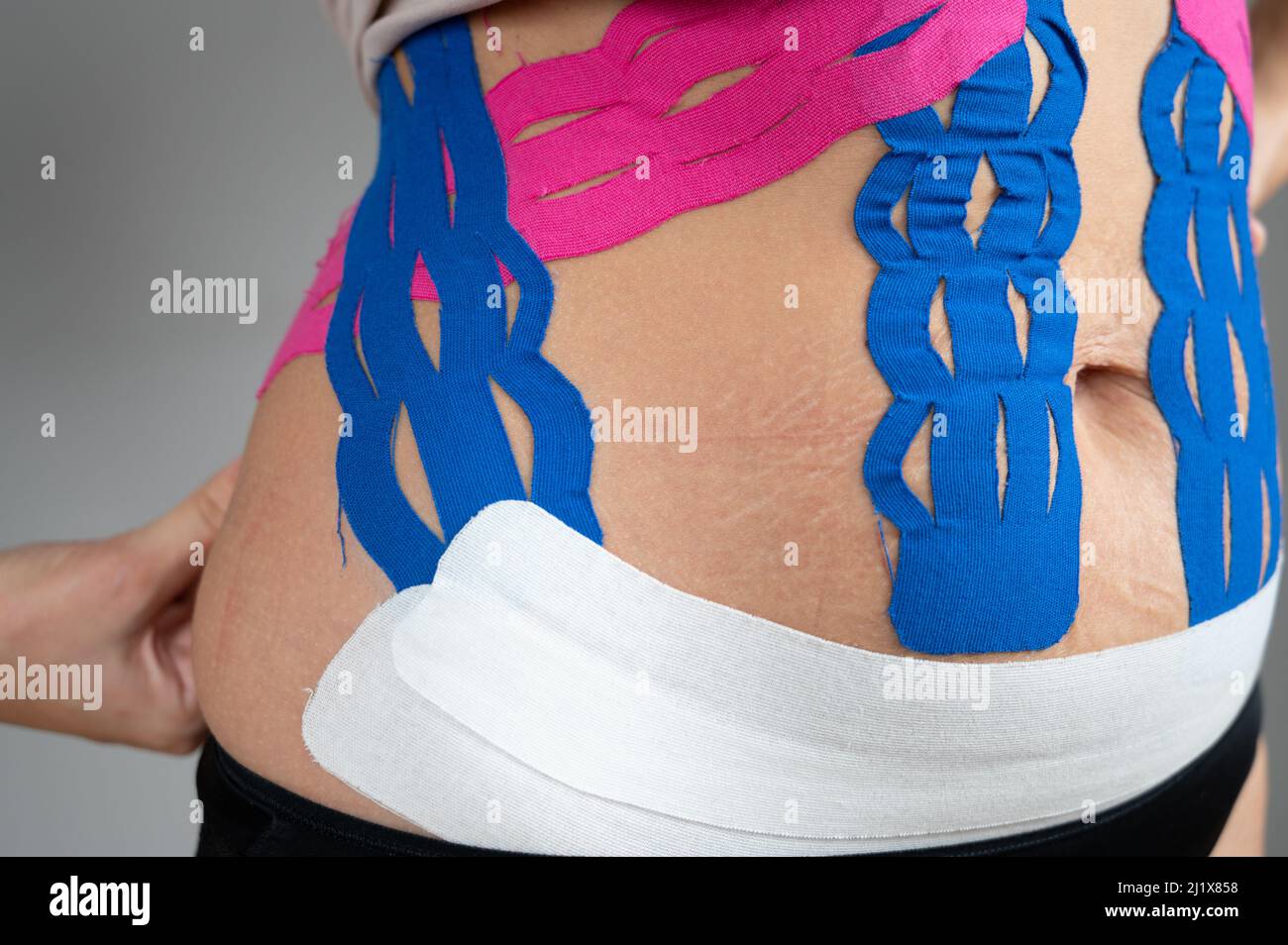 Anti-cellulite procedure for slim belly. Close up of kinesiology tape ...